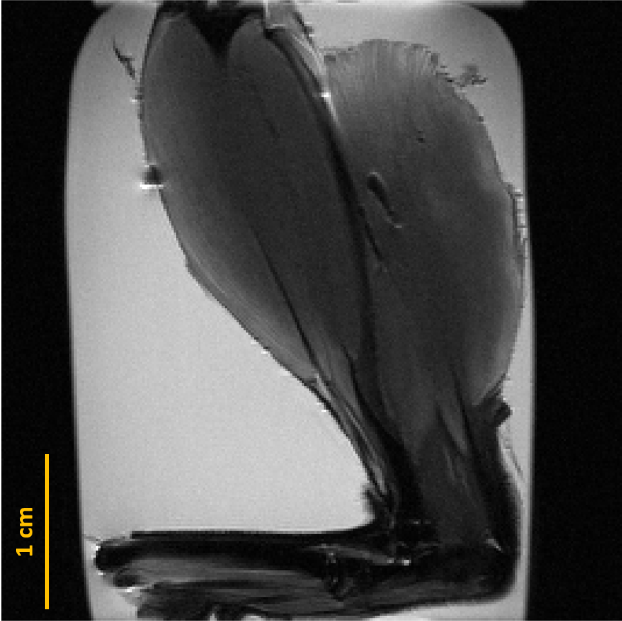 Magnetic resonance imaging
